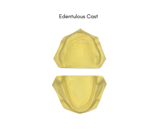 Edentulous Cast – Dental Student Shop